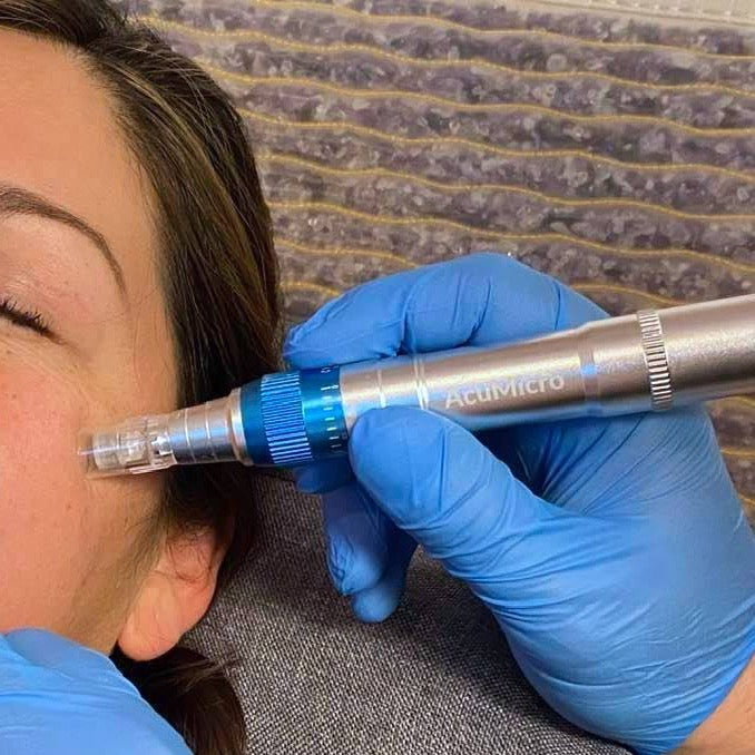 ACUMICRO PLUS+ PEN (Highest RPM) – AcuMicro